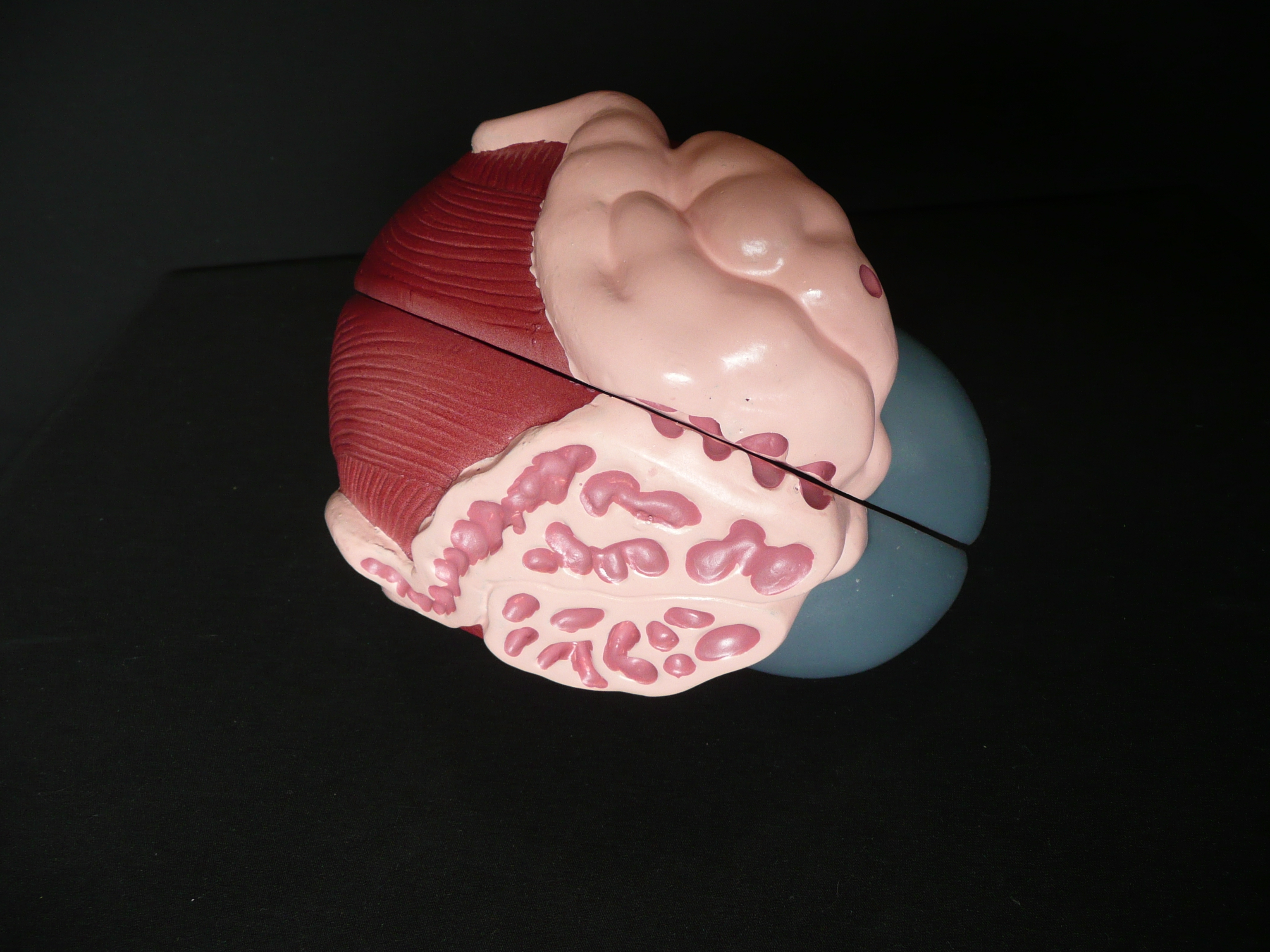 Anatomical Human Male Urinary Bladder Prostate Model | Male Anatomy ...