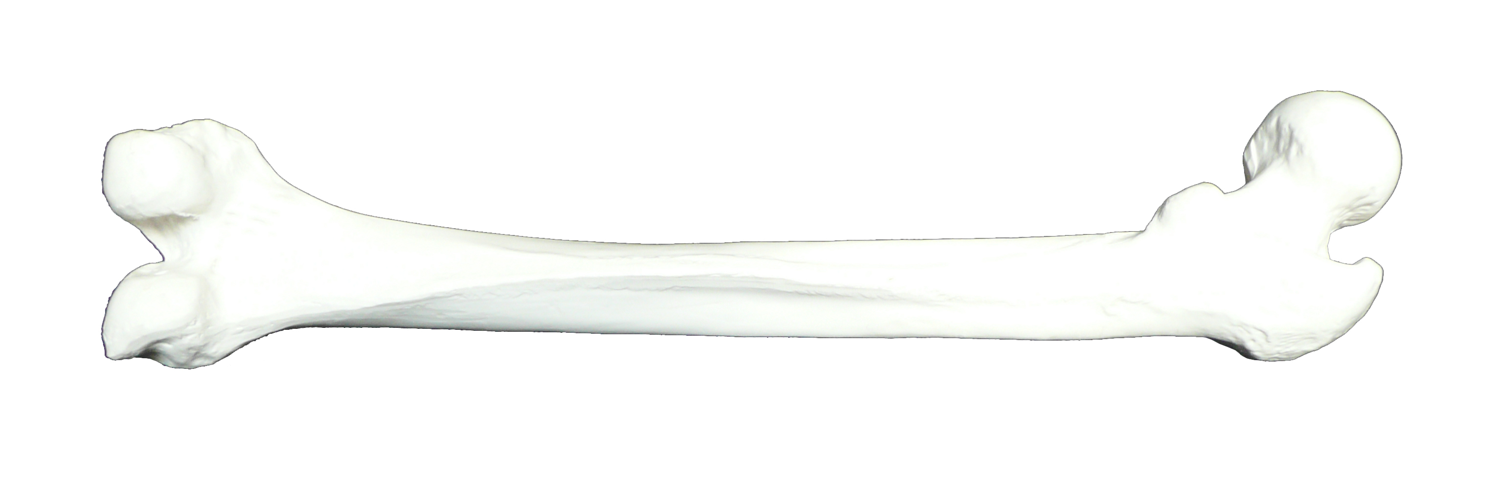 Anatomical Femur Bone of Human Leg Model | Skeletal Components ...